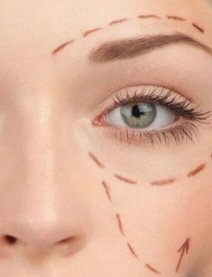Eye Contour Rejuvenation - Jiva Clinic